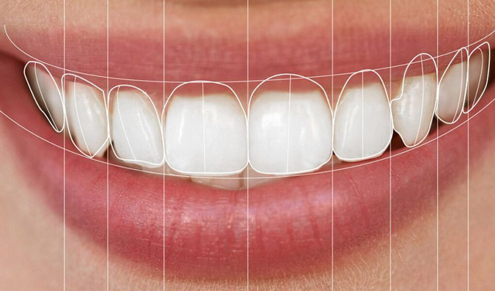 Digital Smile Design Fashion Beauty Blog